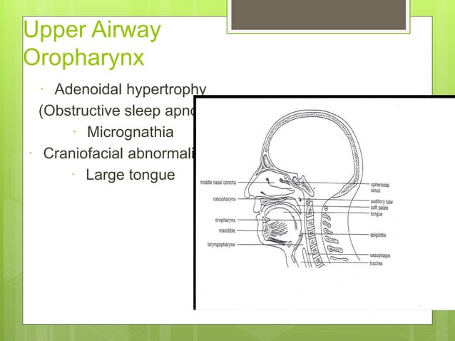 UpperAirwayObstruction.pptx