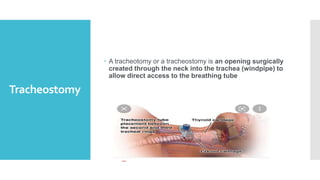 UPPER AIRWAYS OBSTRUCTION.pptx
