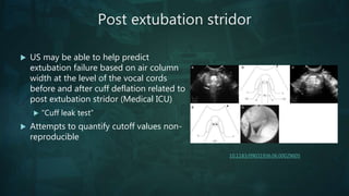 Ultrasound and the Upper Airway | PPTX