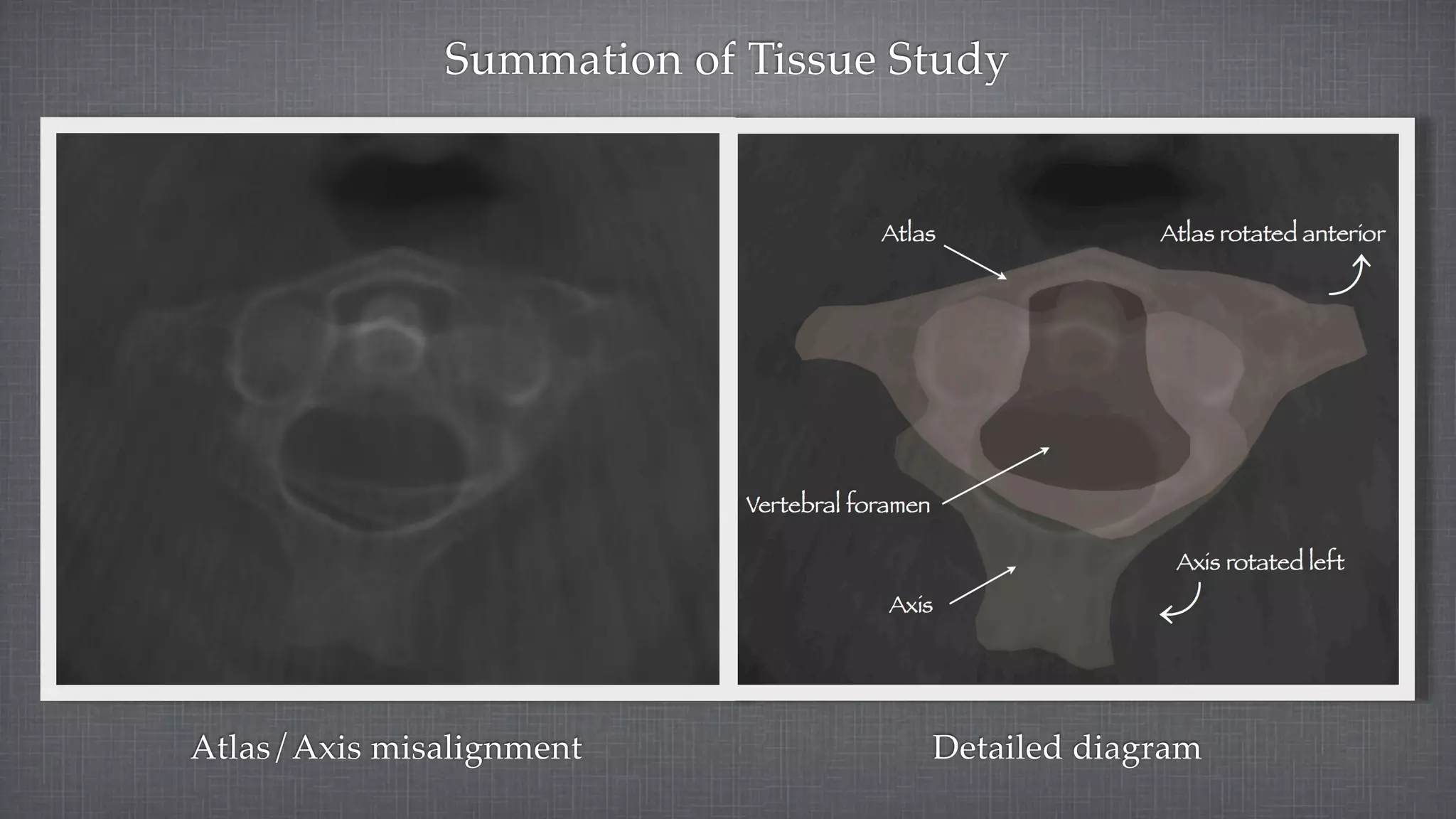 Upper Cervical Cone Beam 3D Preview | PDF