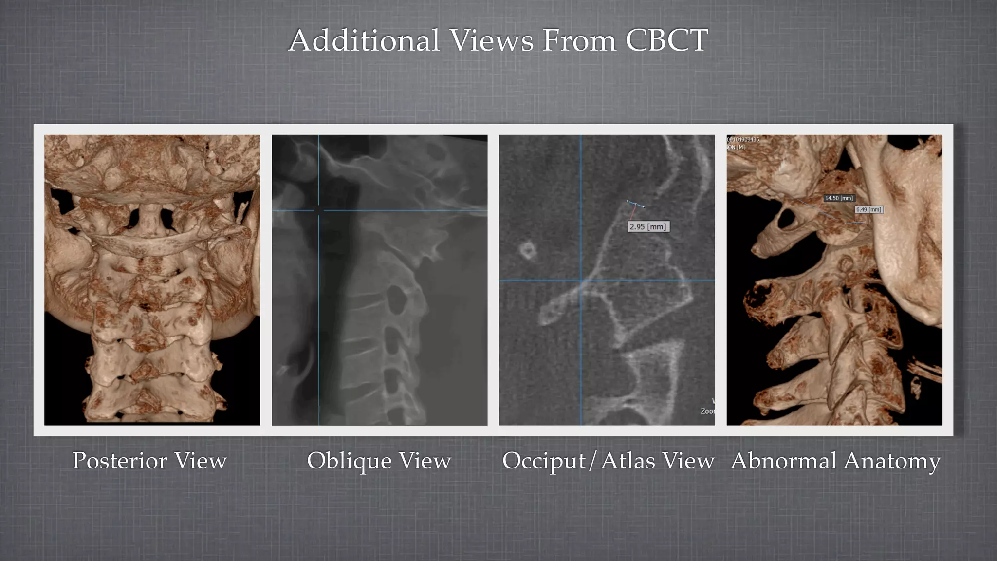 Upper Cervical Cone Beam 3D Preview | PDF