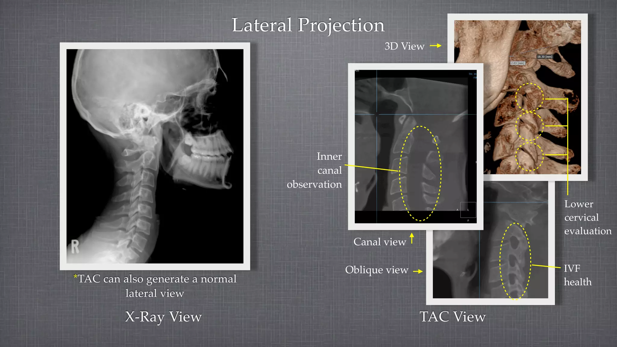 Upper Cervical Cone Beam 3D Preview | PDF