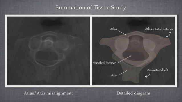Upper Cervical Cone Beam 3D Preview | PDF