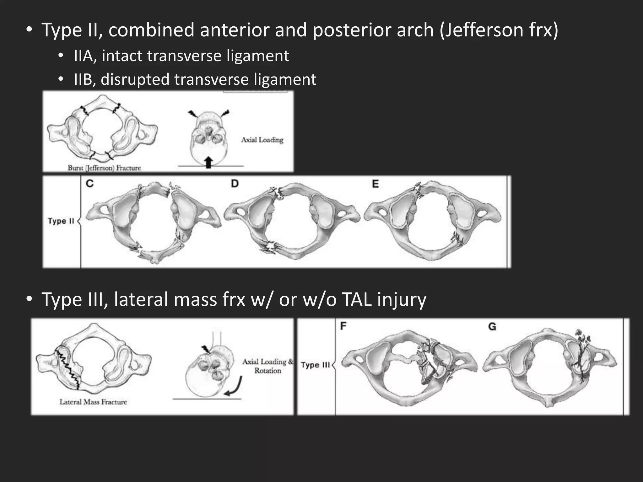 upper cervical trauma.pptx
