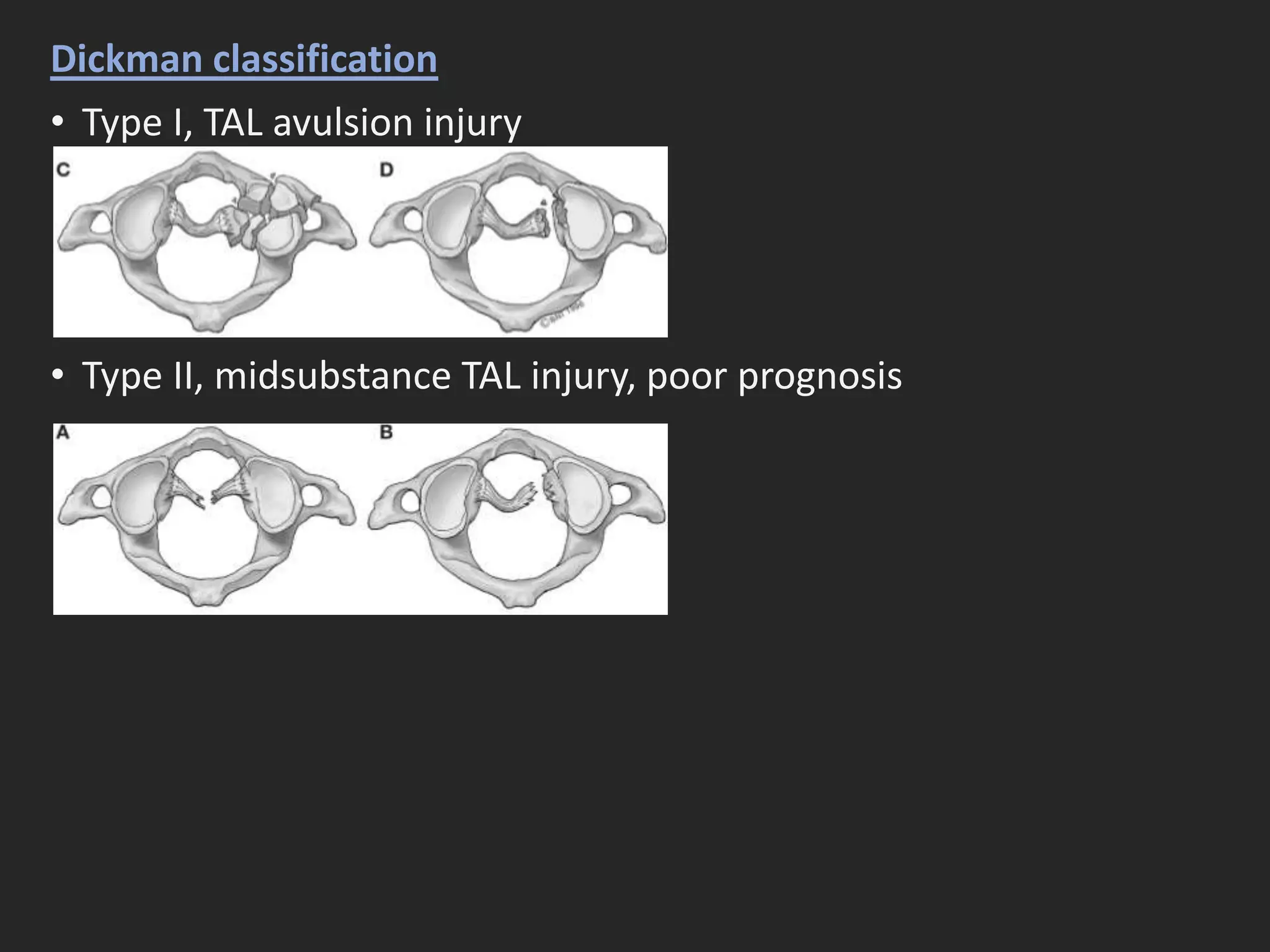 upper cervical trauma.pptx