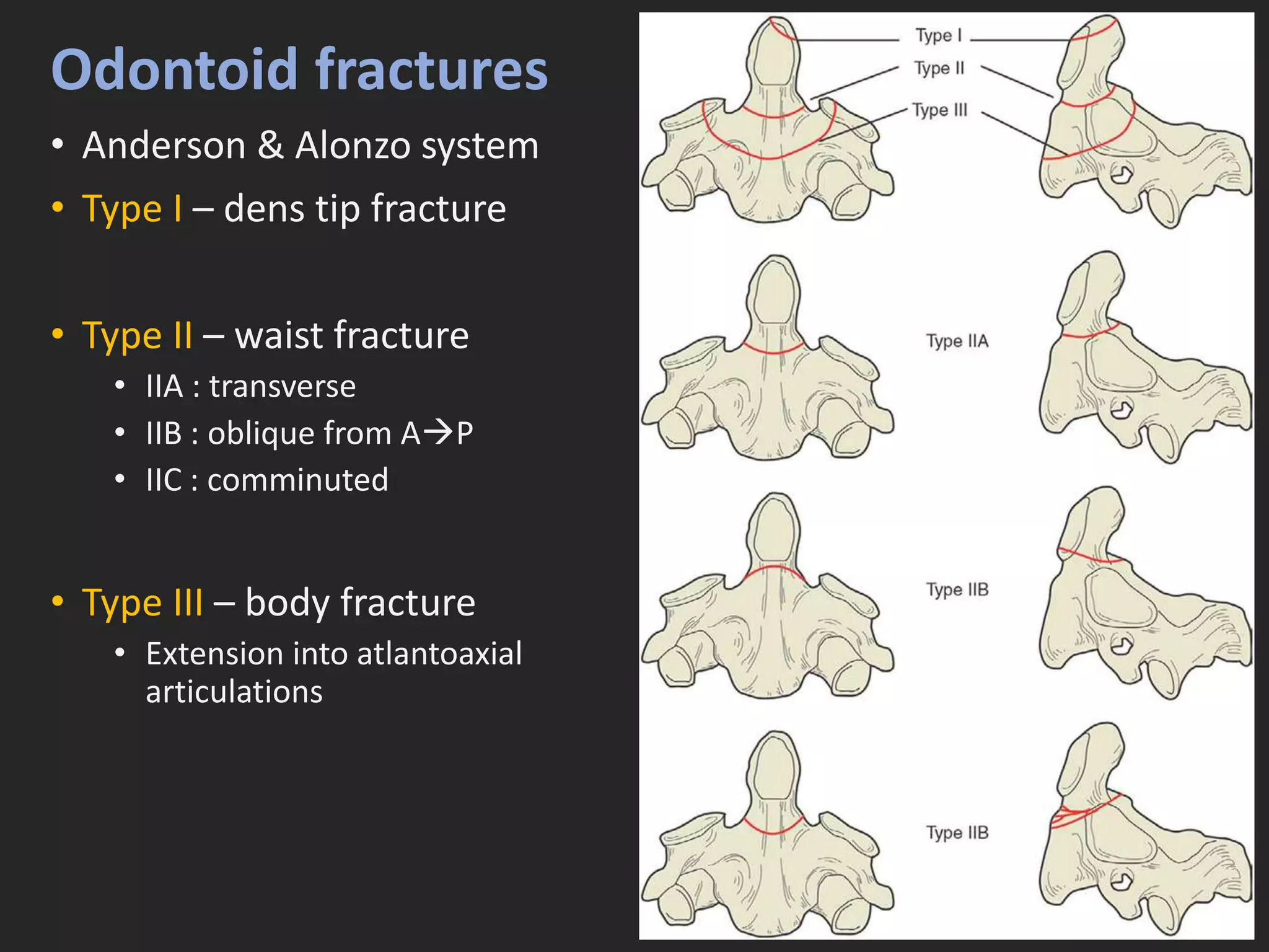 upper cervical trauma.pptx
