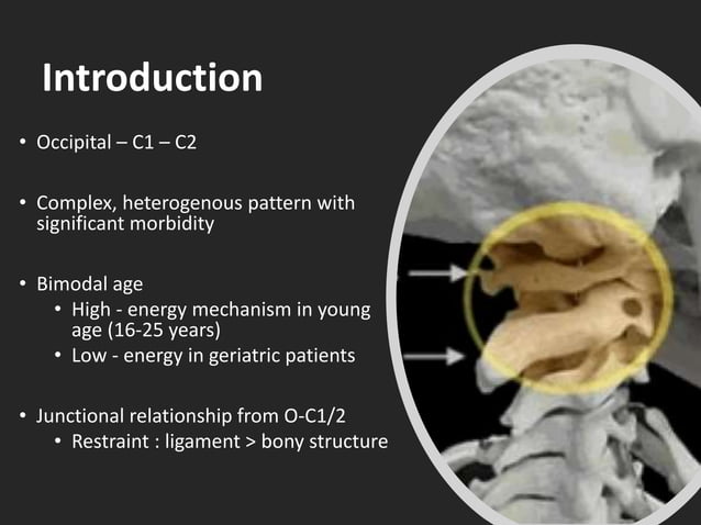 upper cervical trauma.pptx