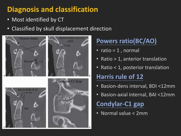 upper cervical trauma.pptx
