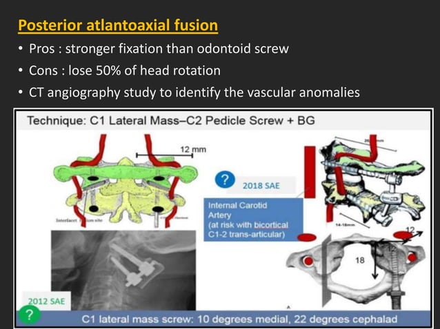 upper cervical trauma.pptx