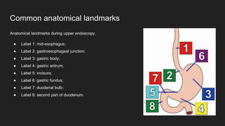 Upper GI endoscopy | PPTX