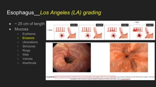Upper GI endoscopy | PPTX