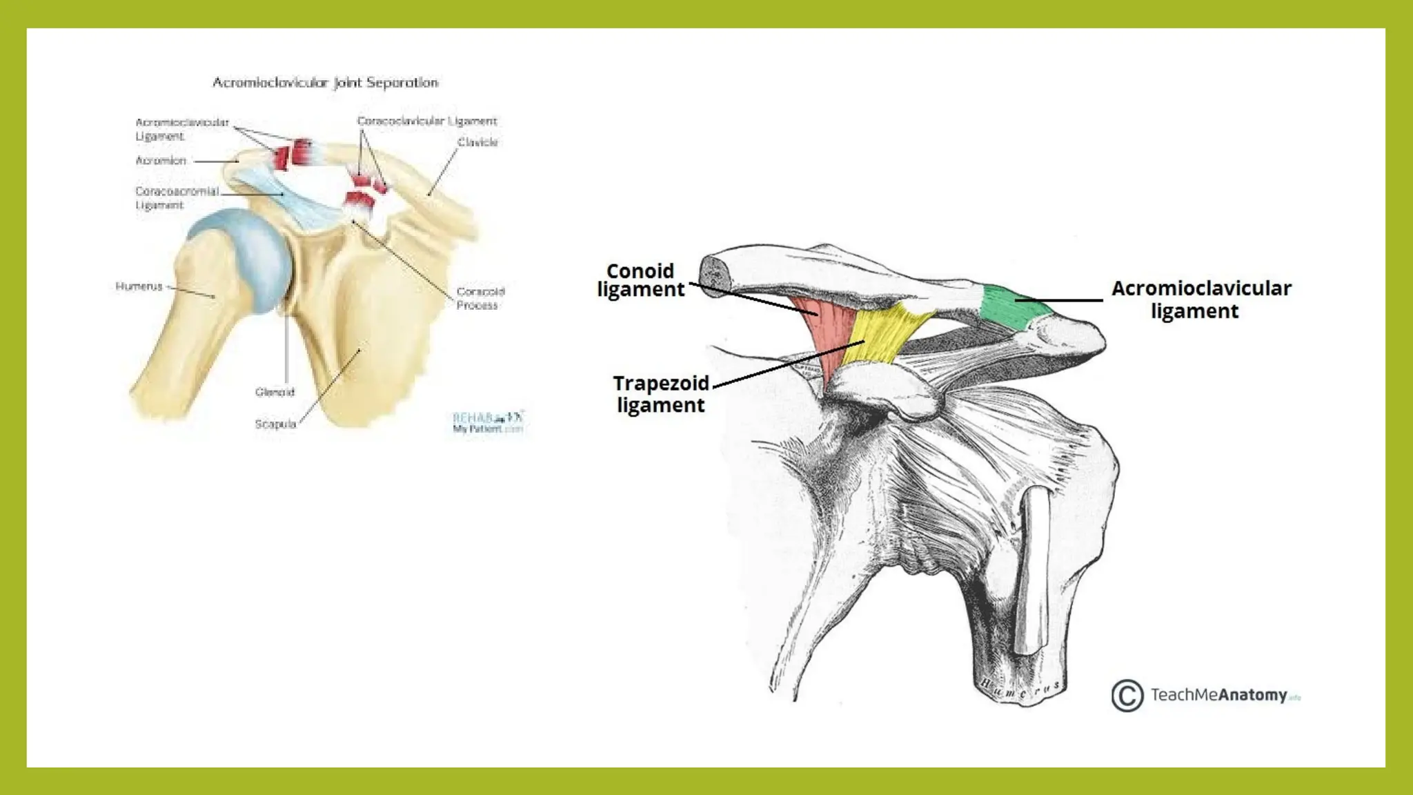 upper extremities.pptxbhxhdhdhdbsbsjsisisjdjdj | PPT