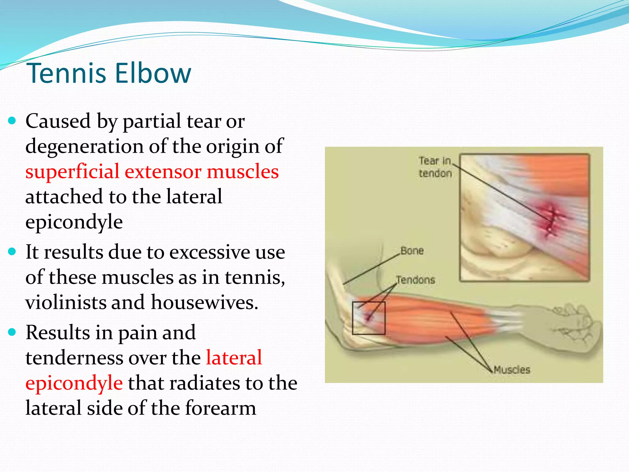 Anatomy of Upper extremity | PPTX