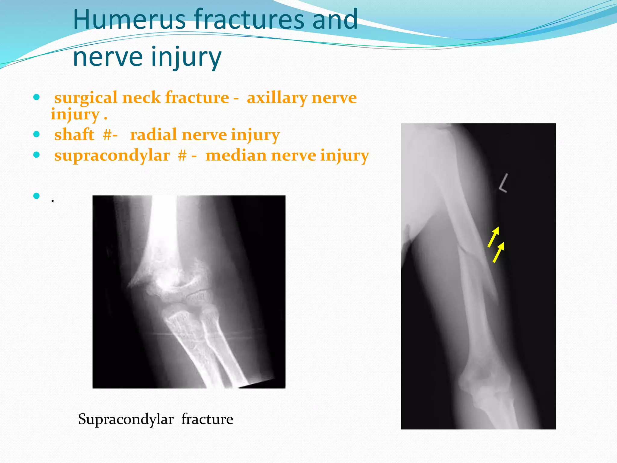 Anatomy of Upper extremity | PPTX