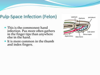 Anatomy of Upper extremity | PPTX