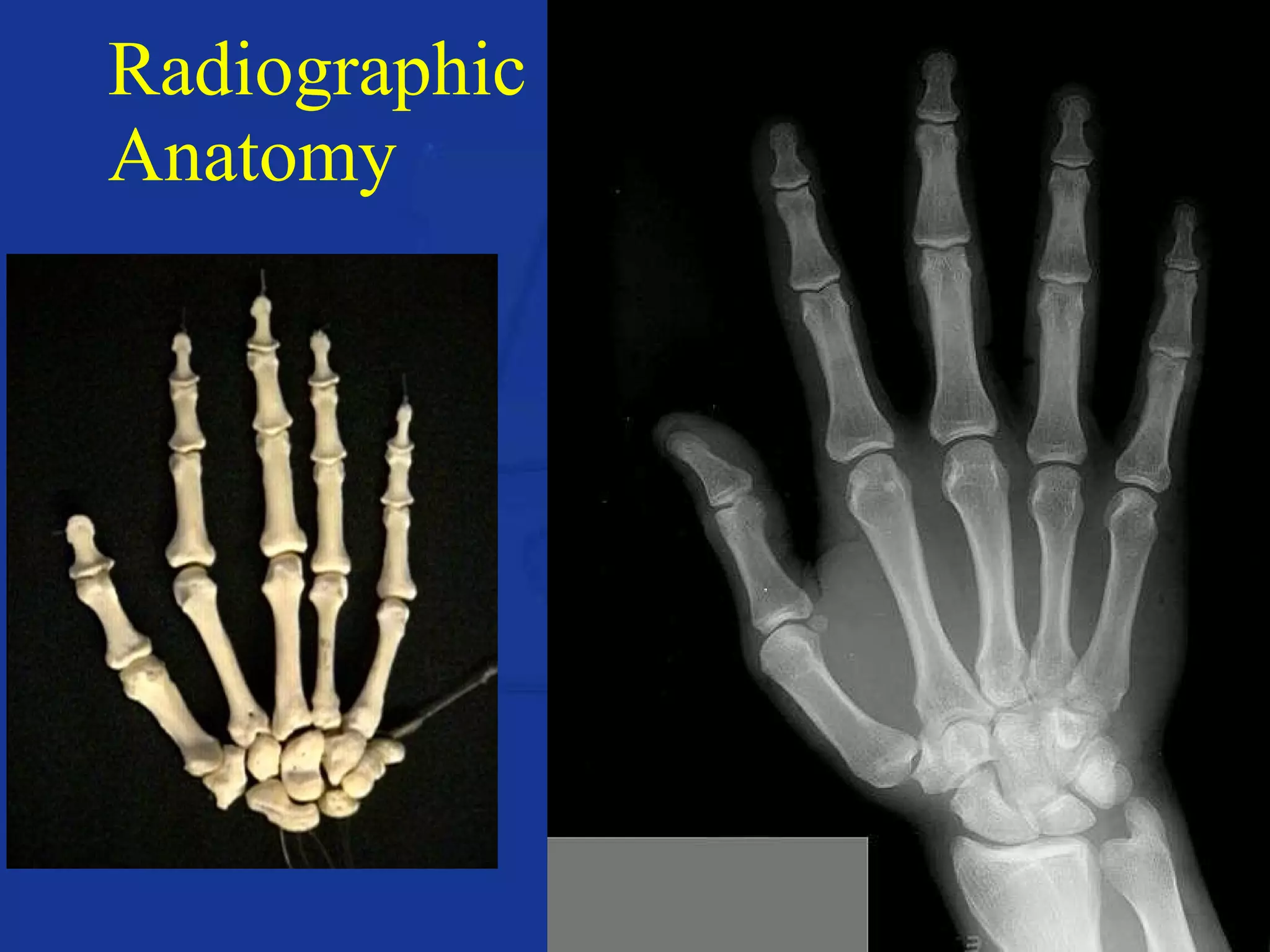 Upper extremity anatomy & positioning | PPT