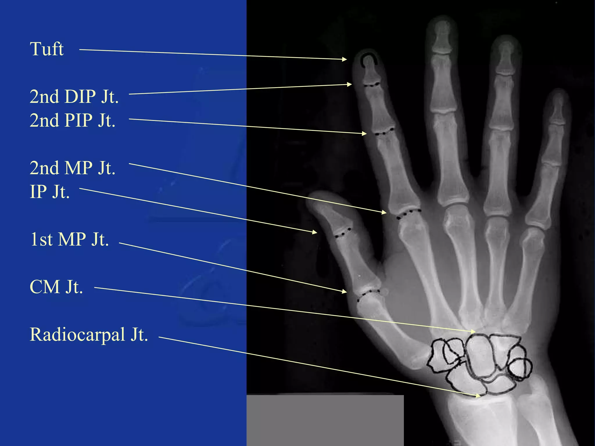 Upper extremity anatomy & positioning | PPT