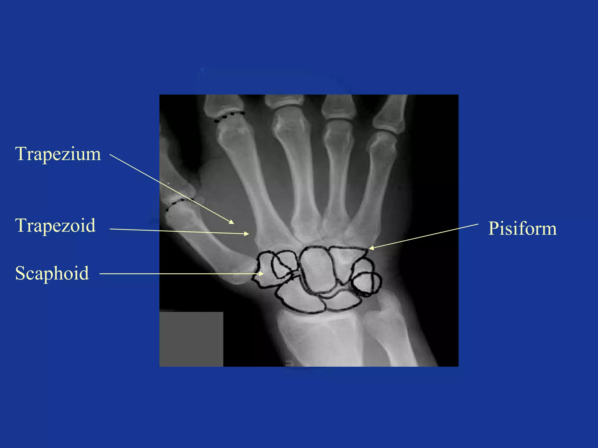Upper extremity anatomy & positioning | PPT