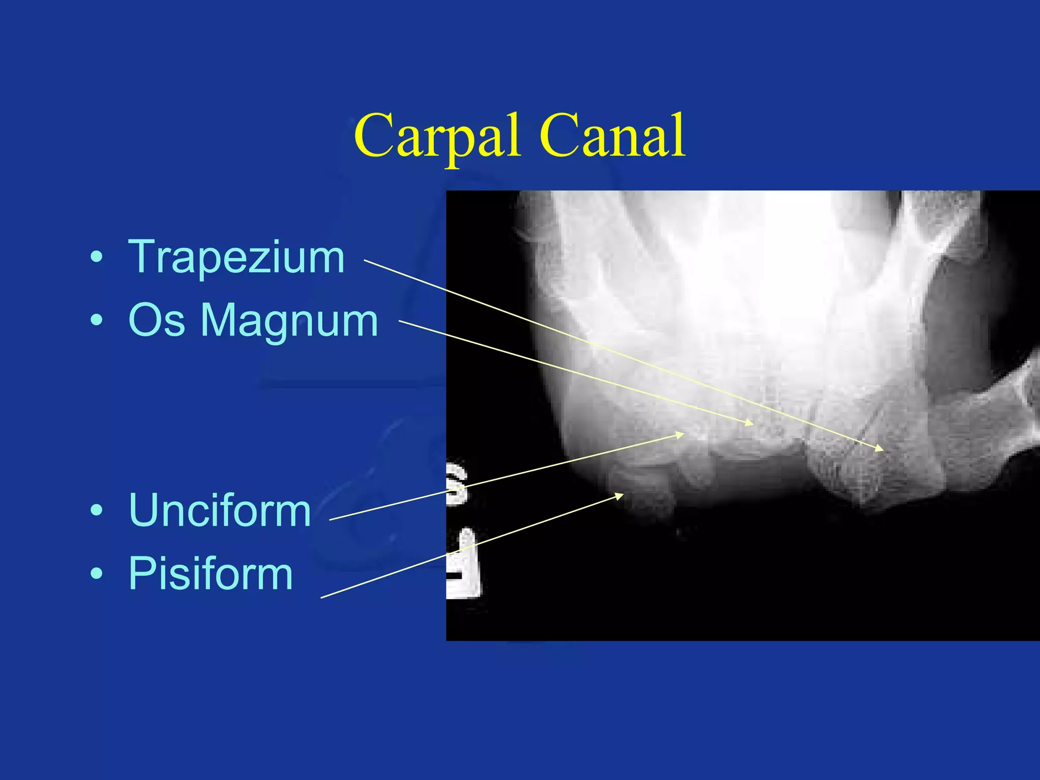 Upper extremity anatomy & positioning | PPT