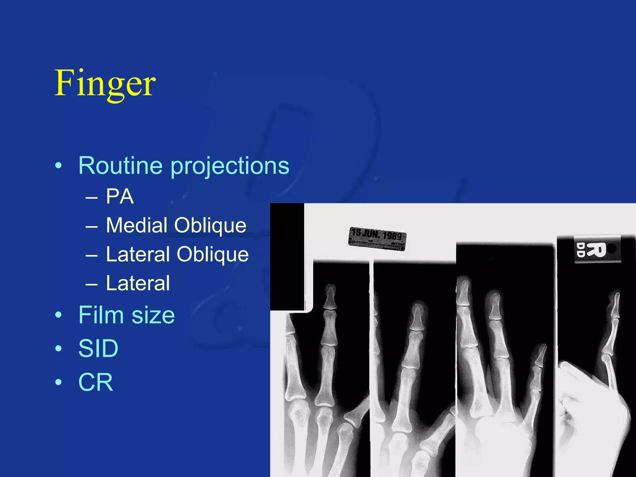 Upper extremity anatomy & positioning | PPT