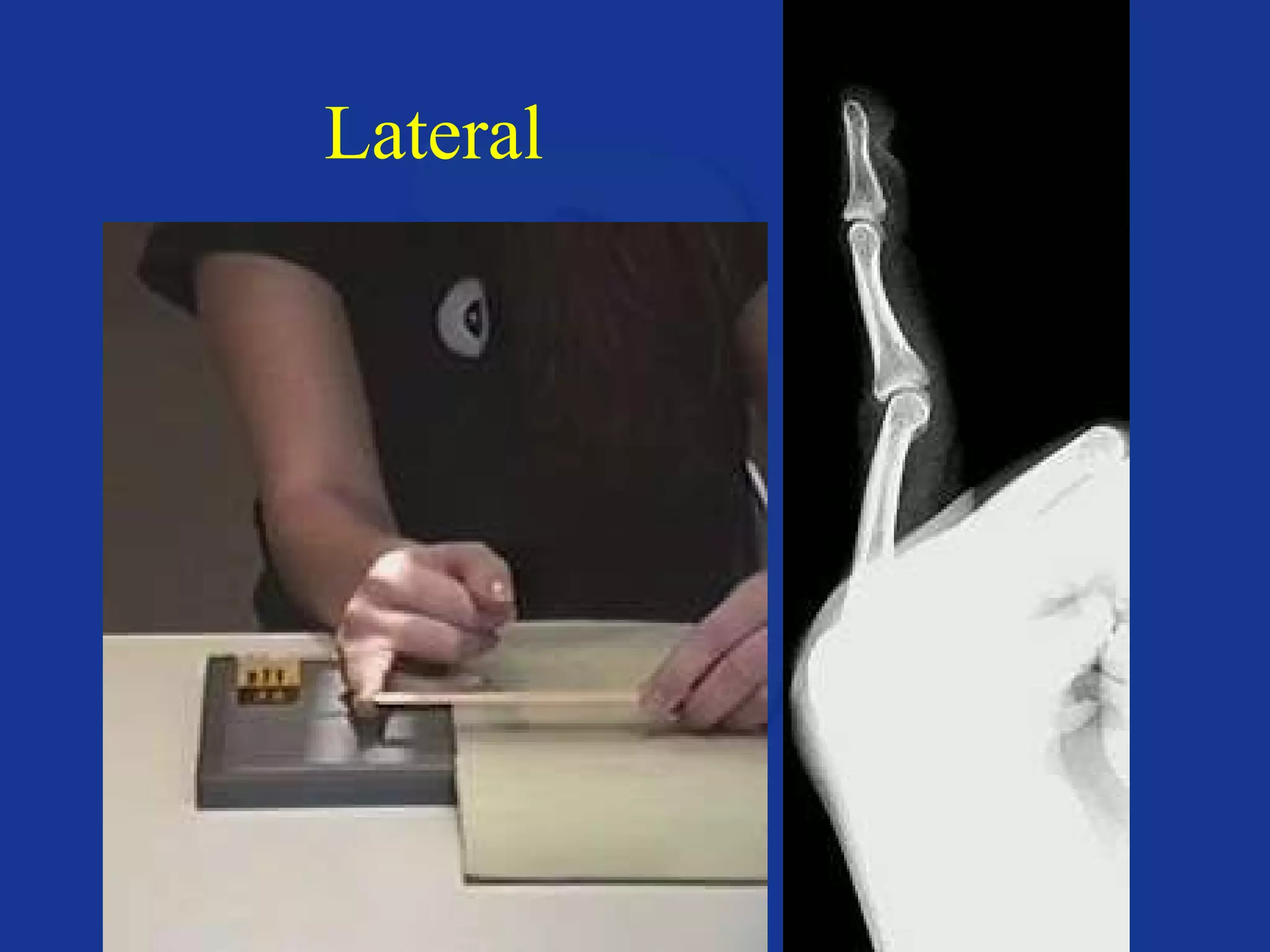 Upper extremity anatomy & positioning | PPT