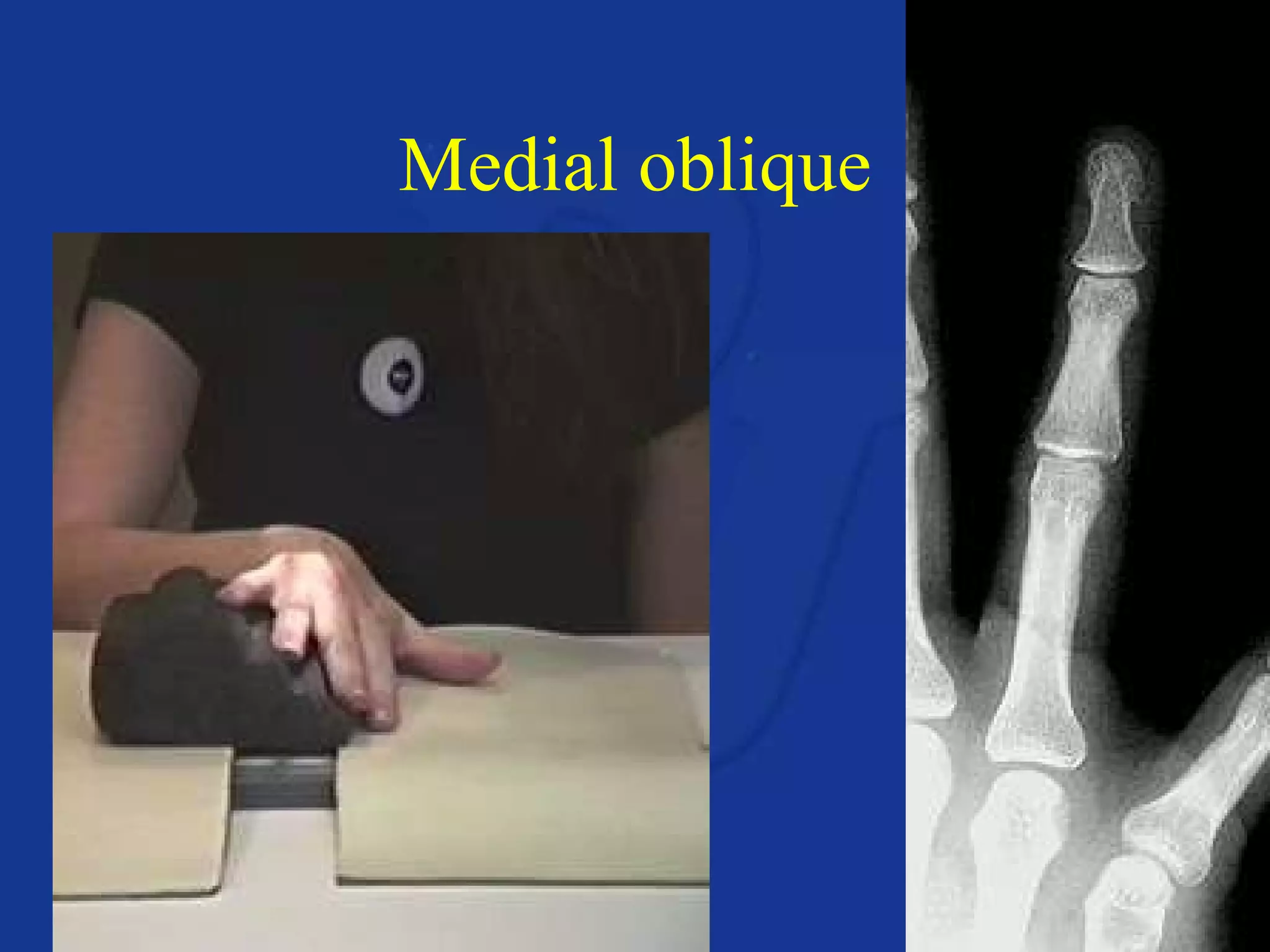 Upper extremity anatomy & positioning | PPT