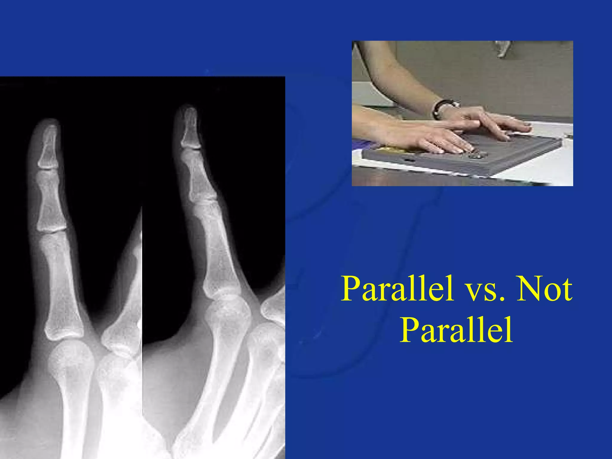 Upper extremity anatomy & positioning | PPT