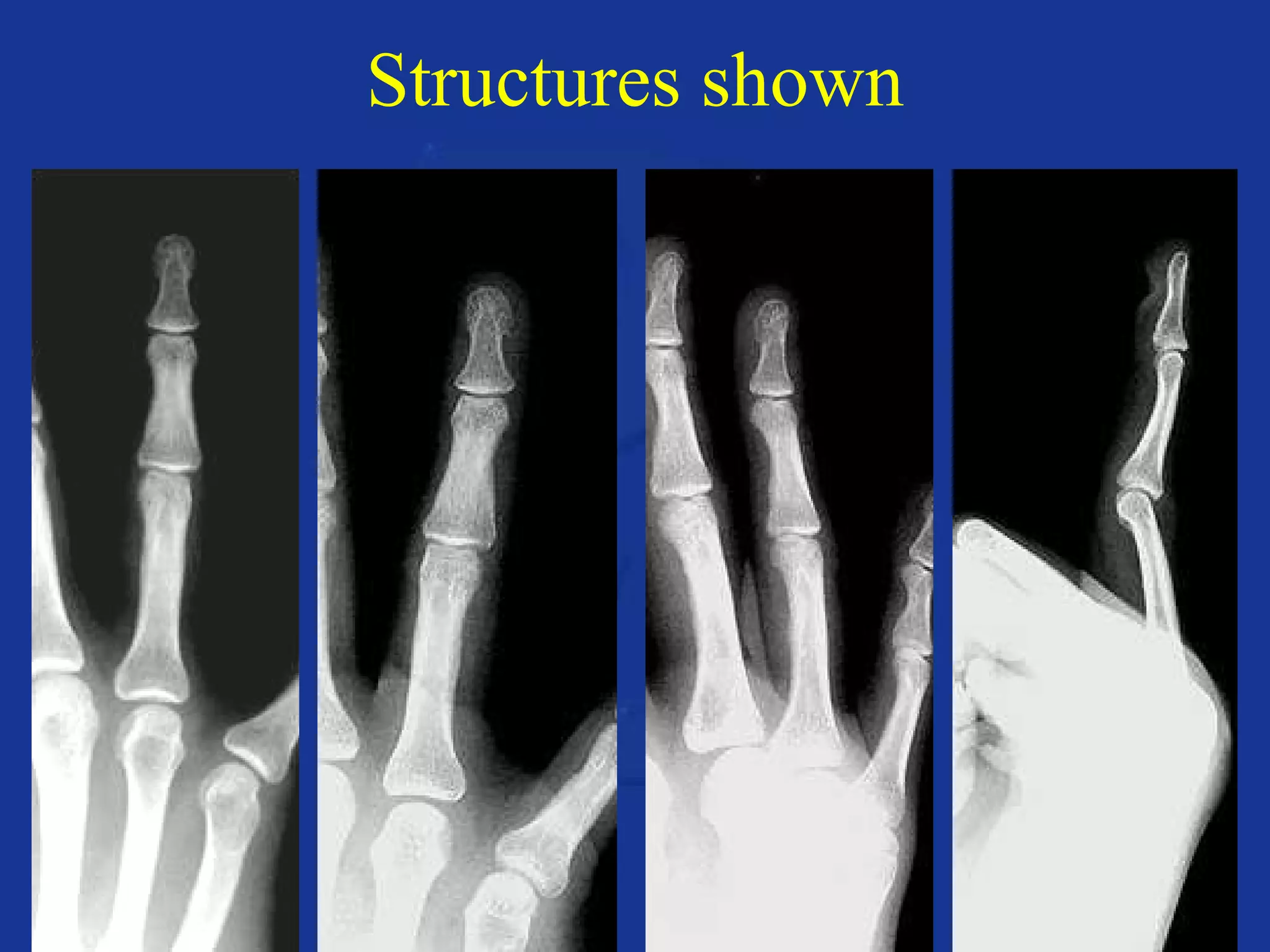 Upper extremity anatomy & positioning | PPT