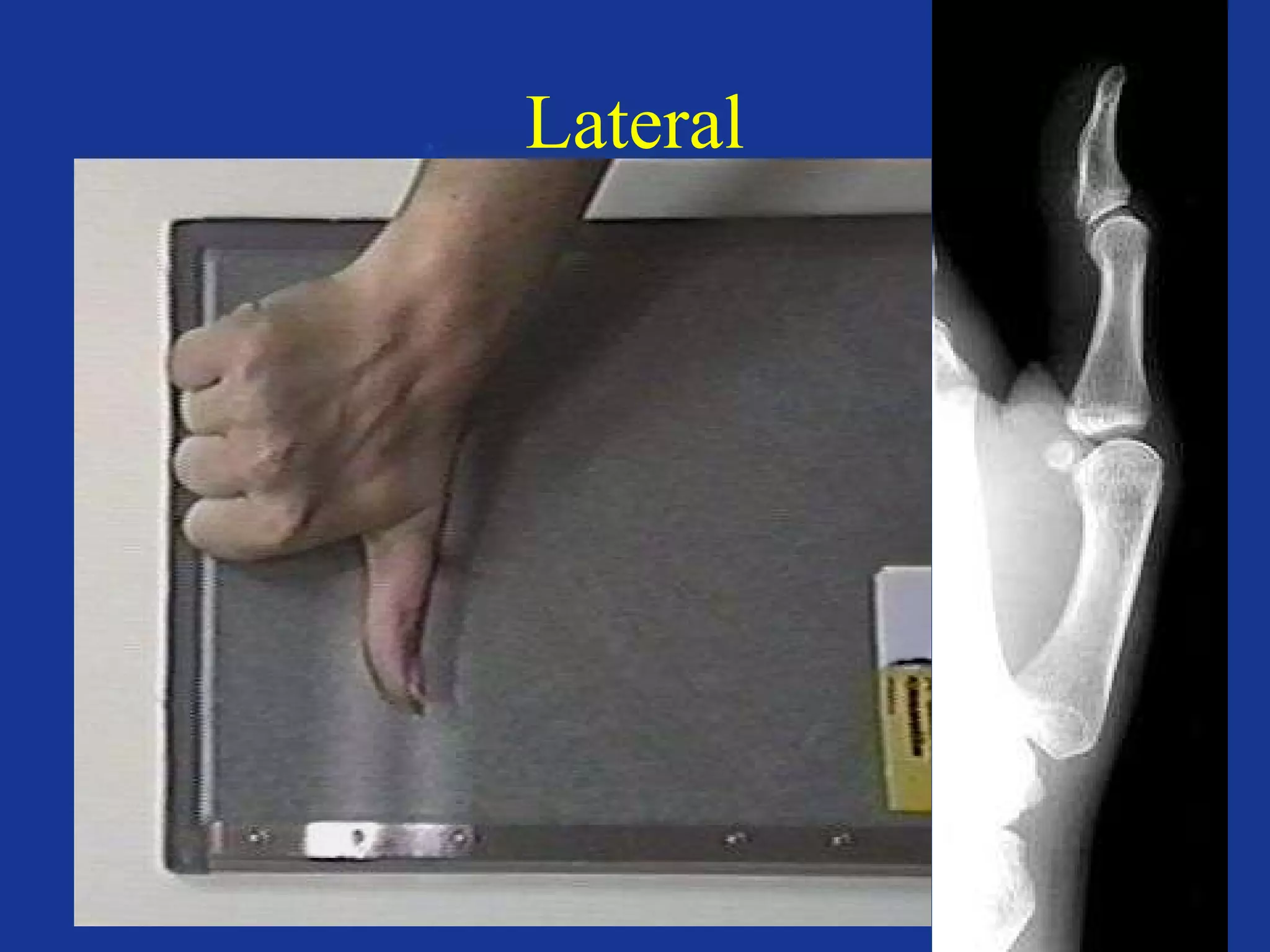 Upper extremity anatomy & positioning | PPT