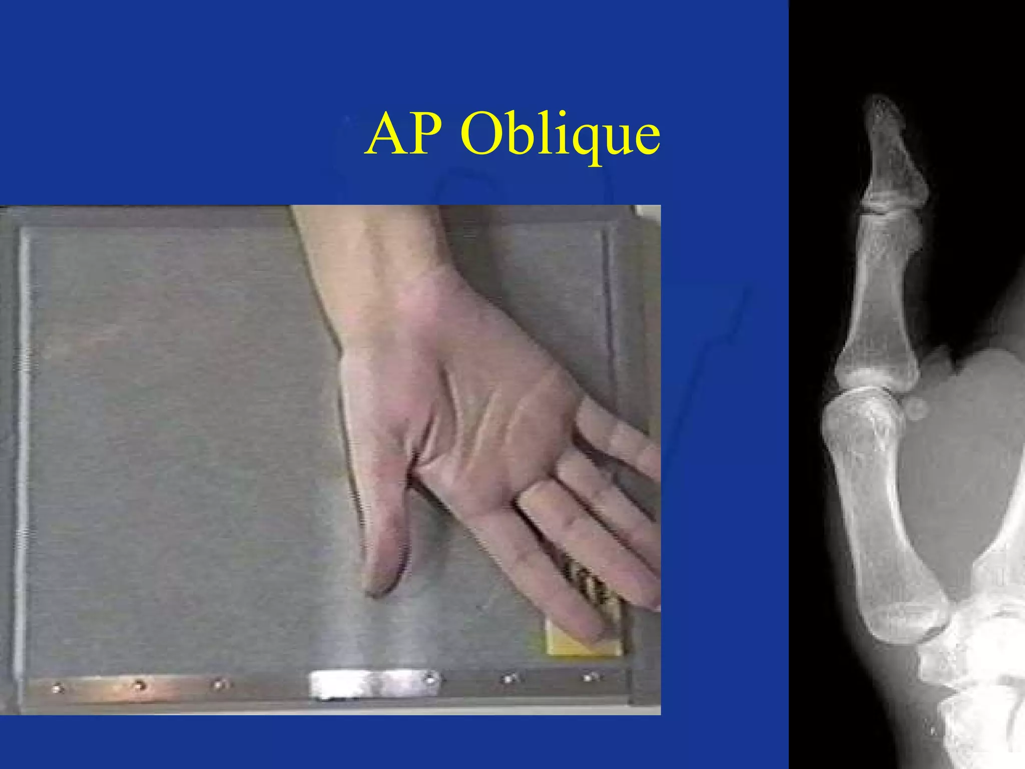 Upper extremity anatomy & positioning | PPT