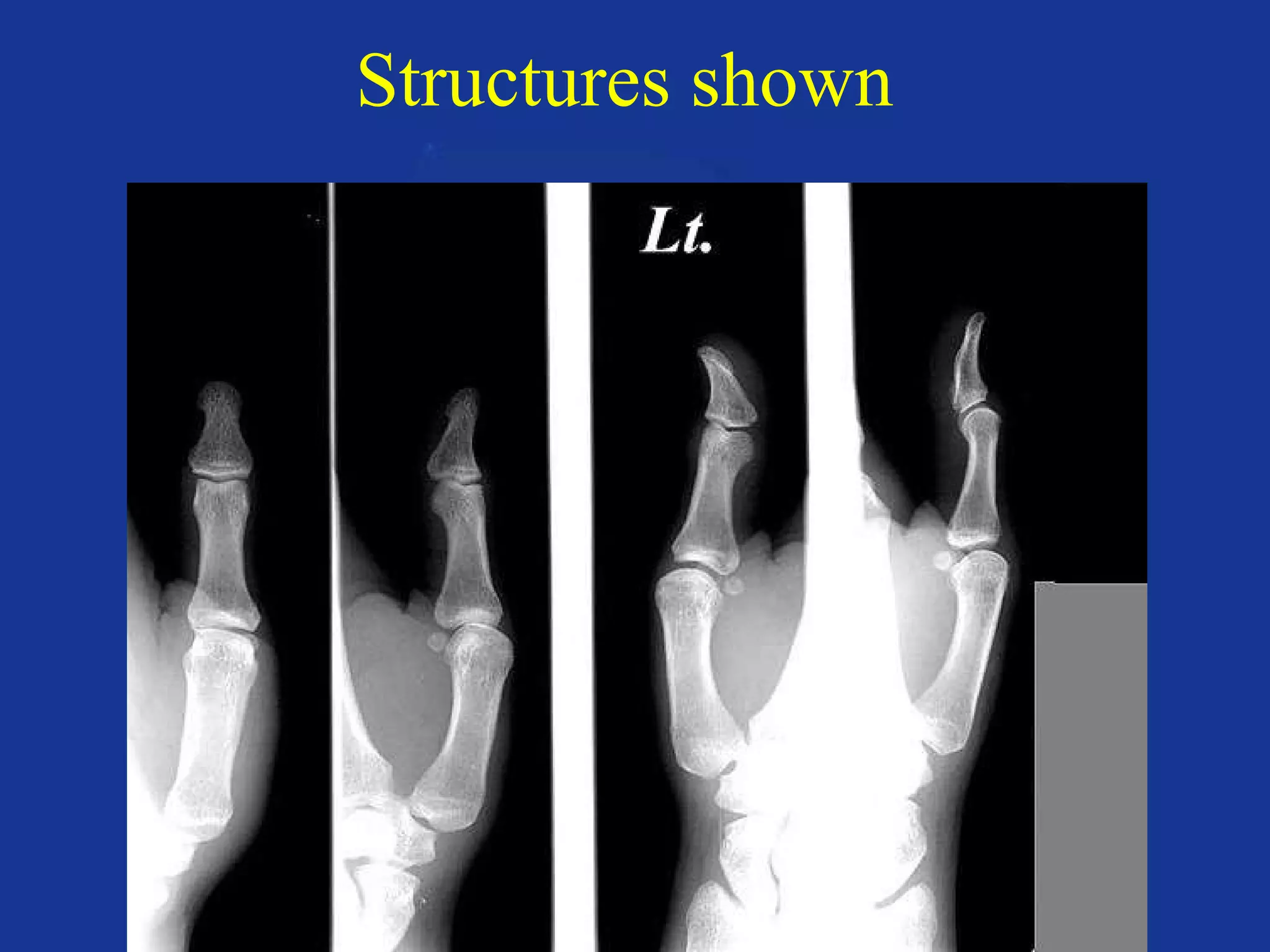 Upper extremity anatomy & positioning | PPT