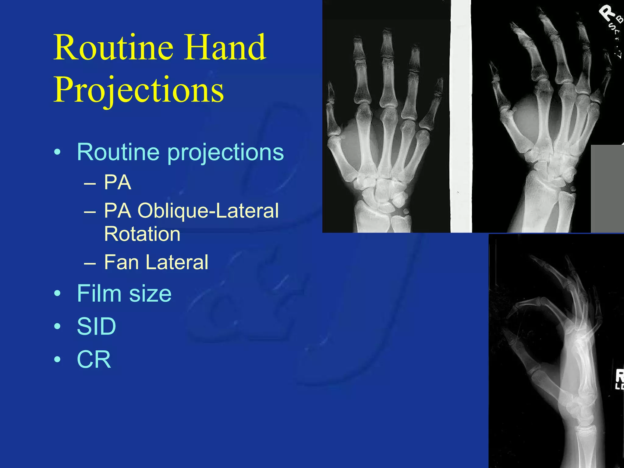 Upper extremity anatomy & positioning | PPT