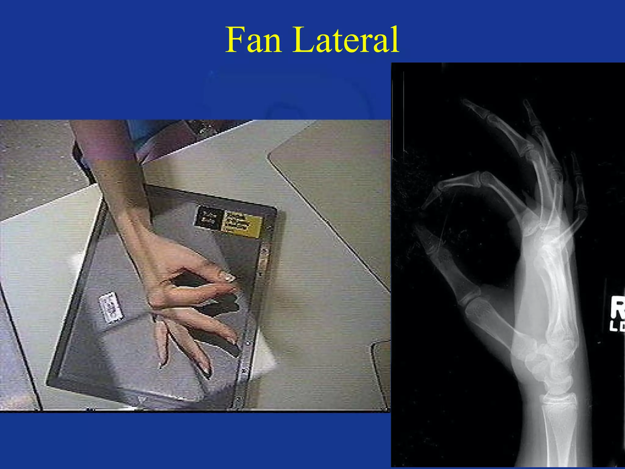 Upper extremity anatomy & positioning | PPT