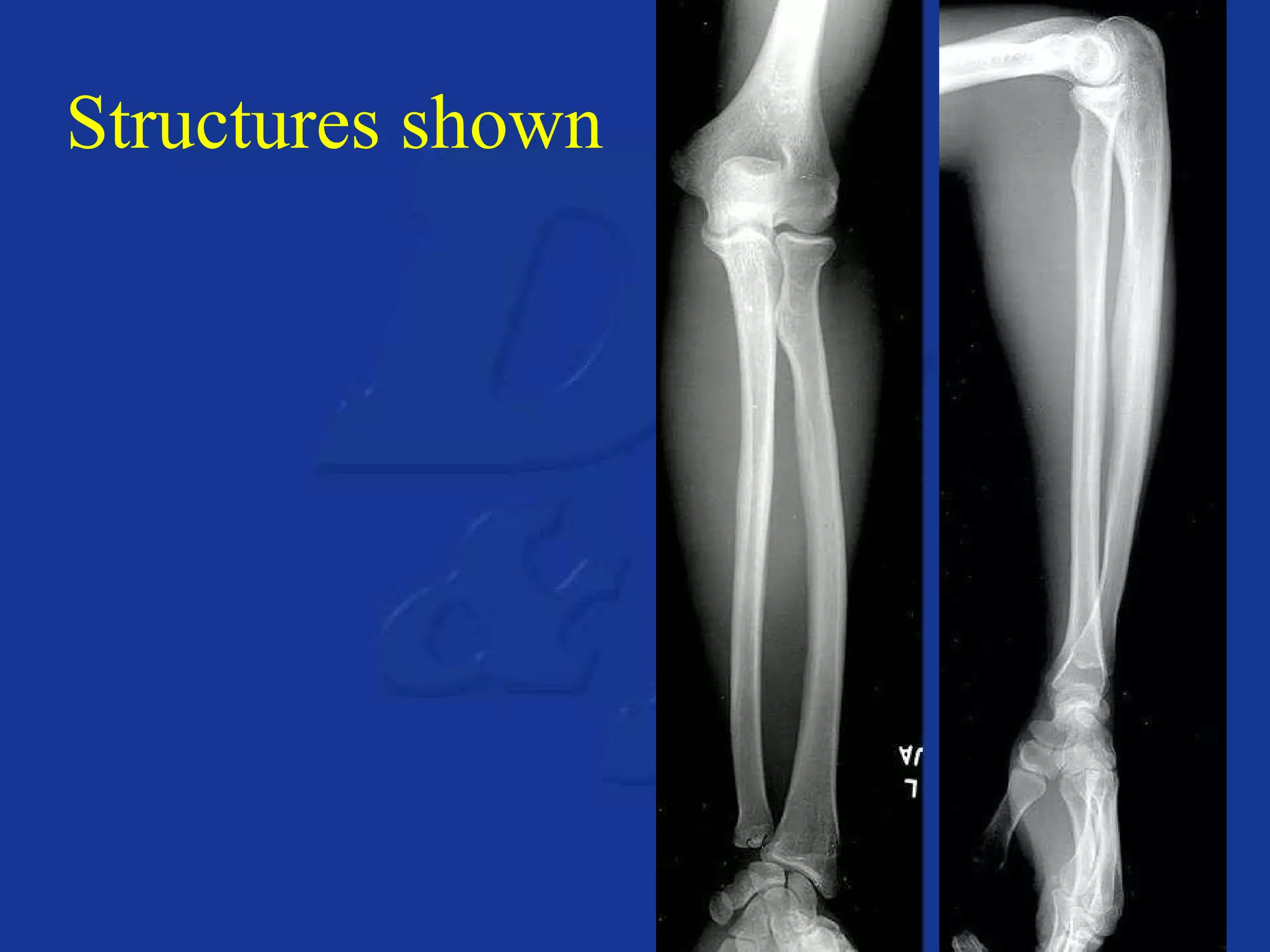 Upper extremity anatomy & positioning | PPT