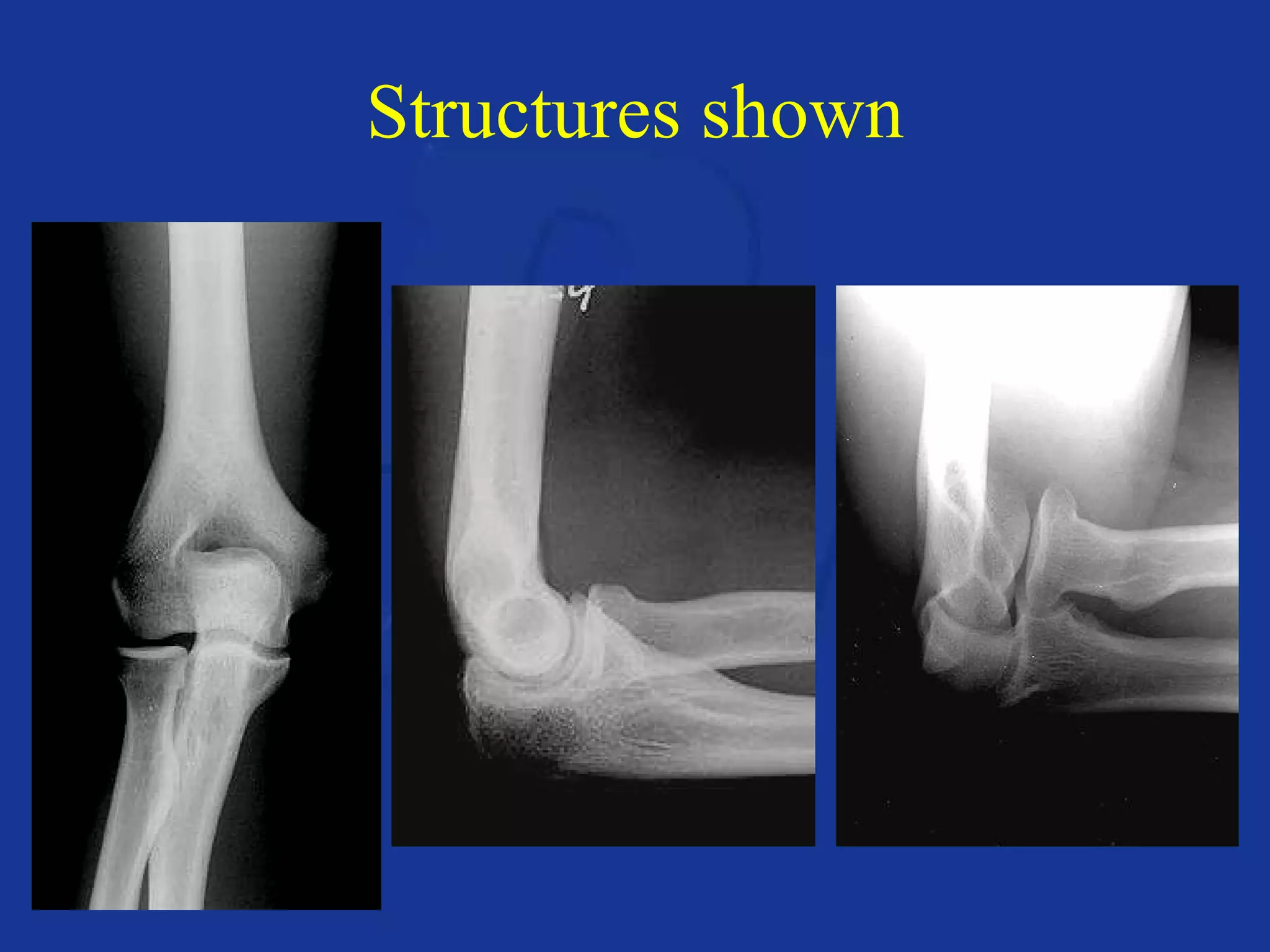 Upper extremity anatomy & positioning | PPT