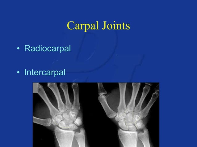 Upper extremity anatomy & positioning | PPT | Death, Injury, or ...