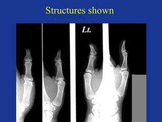 Upper extremity anatomy & positioning | PPT