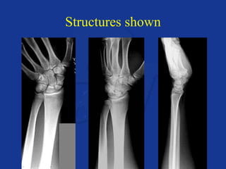 Upper extremity anatomy & positioning | PPT