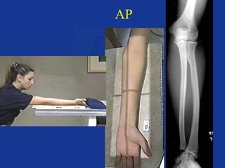Upper extremity anatomy & positioning | PPT