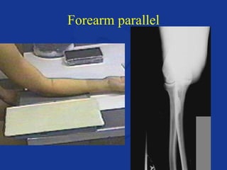 Upper extremity anatomy & positioning | PPT