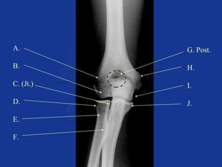 Distal Upper Extremity Anatomy