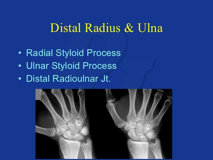Distal Upper Extremity Anatomy