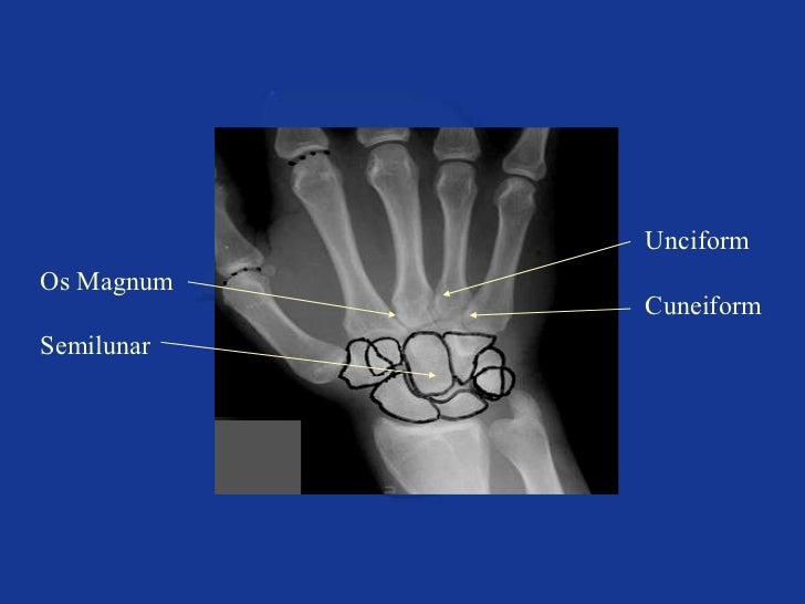 Upper extremity anatomy & positioning