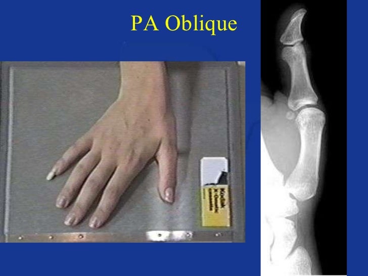 Upper extremity anatomy & positioning