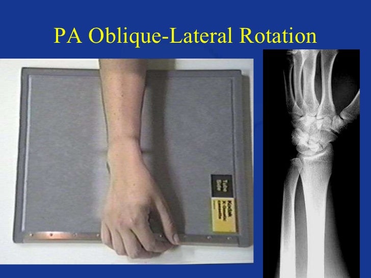 Upper extremity anatomy & positioning