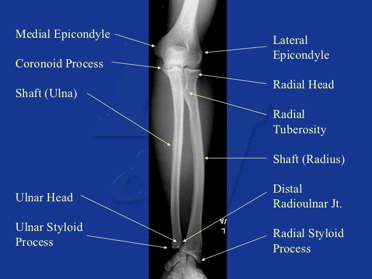 Distal Upper Extremity Anatomy