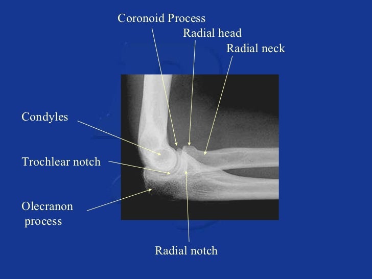 Upper extremity anatomy & positioning