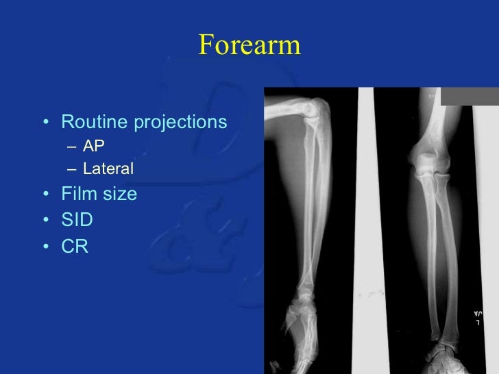 Upper extremity anatomy & positioning