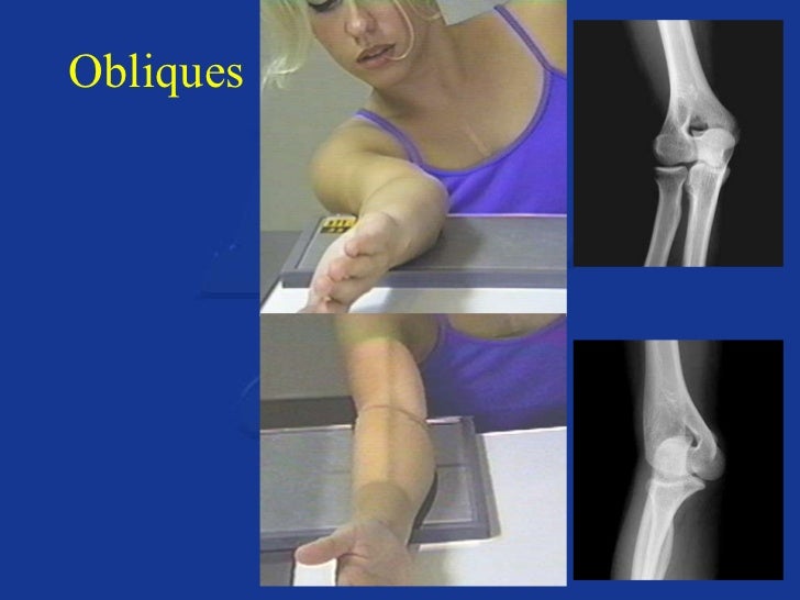 Upper extremity anatomy & positioning