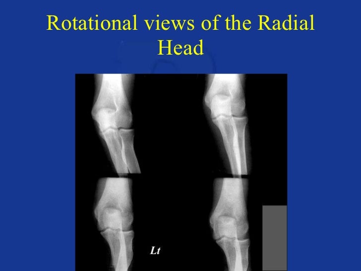 Upper extremity anatomy & positioning